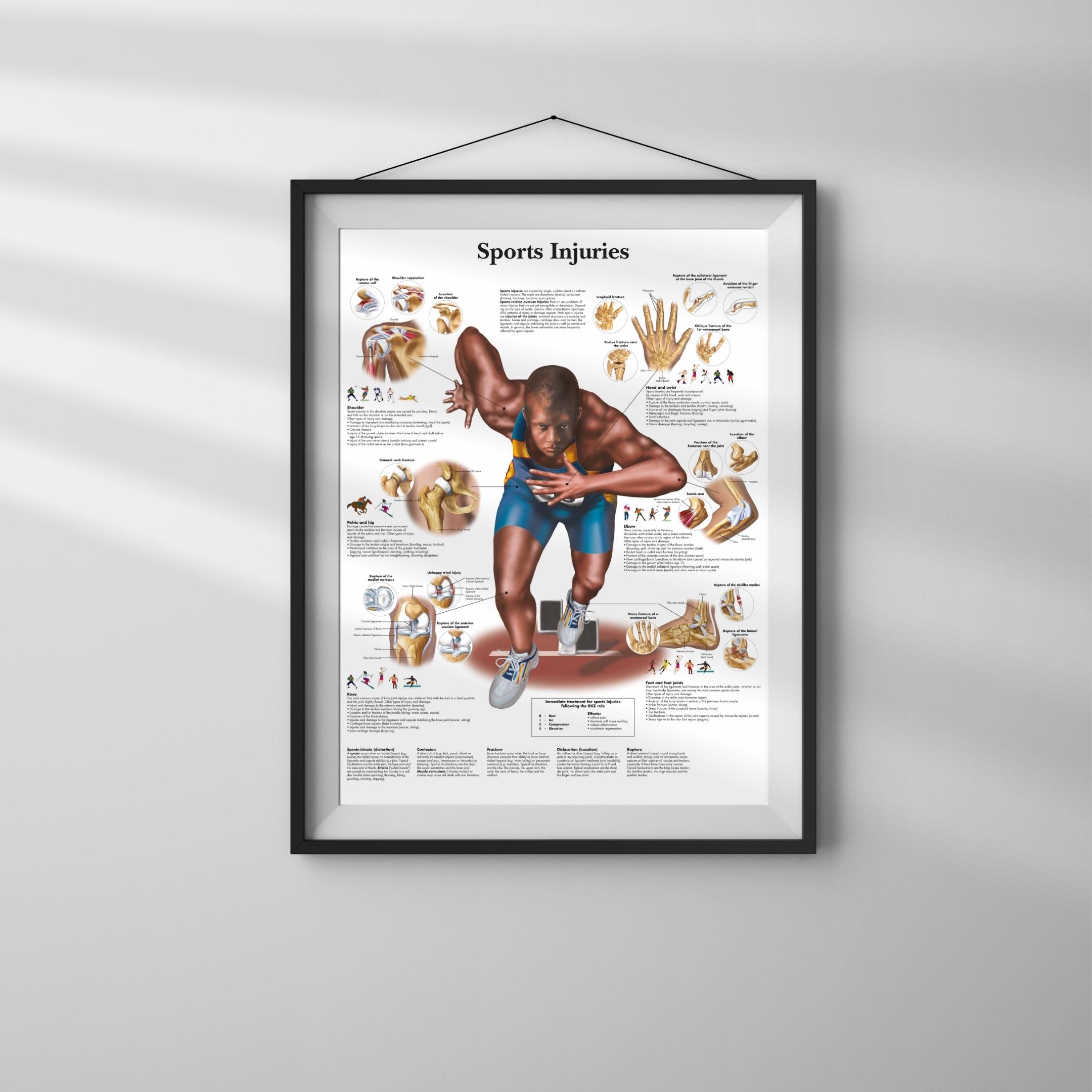 Sports Injuries Chart Anatomy Human Physiology Charts Medical Student ...