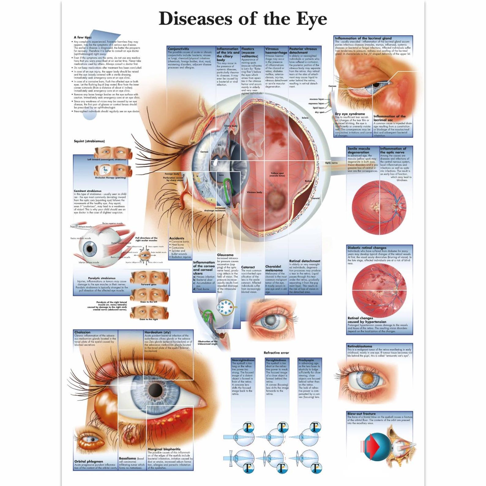 Diseases of the Eye Chart Anatomy Human Physiology Charts Medical ...
