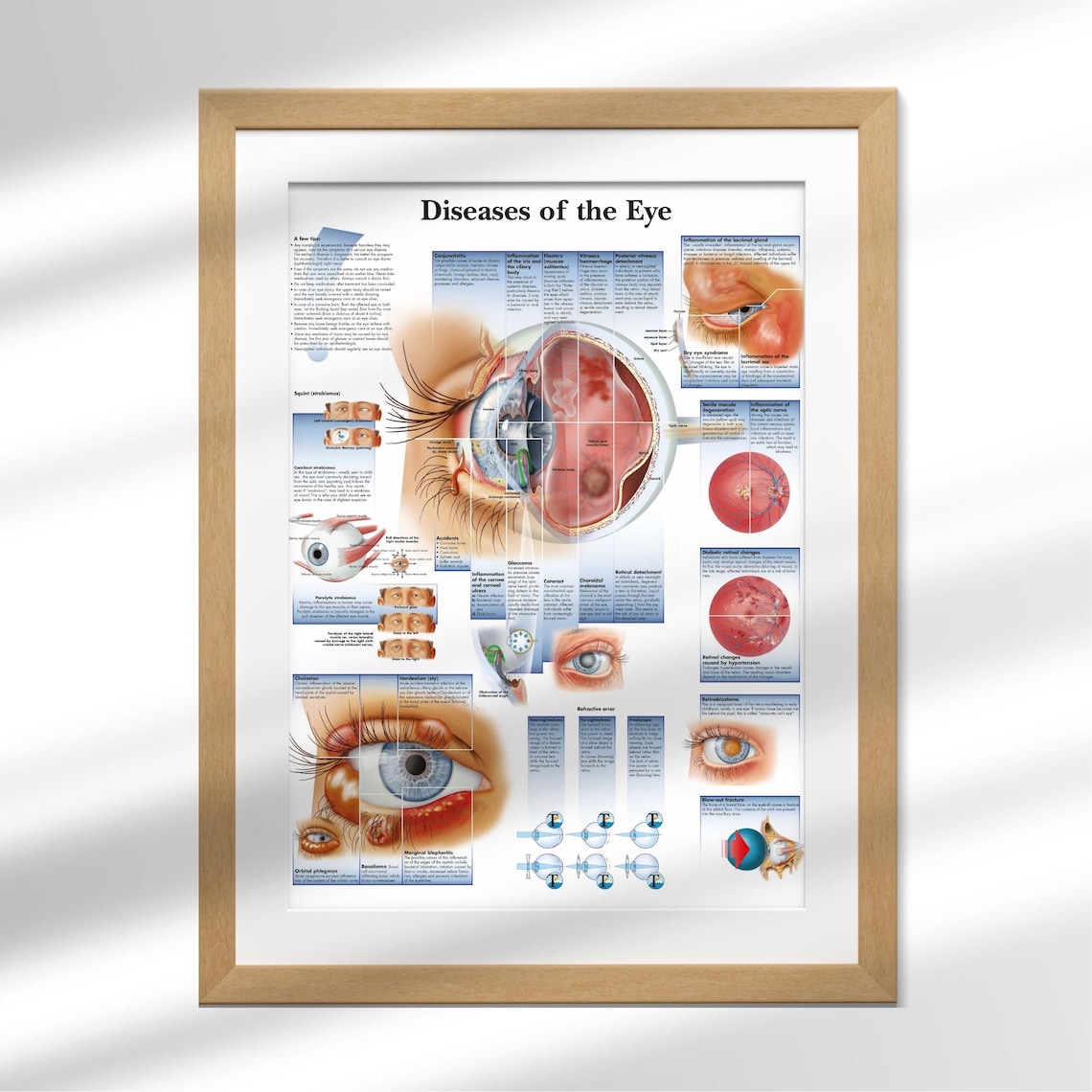 Diseases of the Eye Chart Anatomy Human Physiology Charts Medical ...