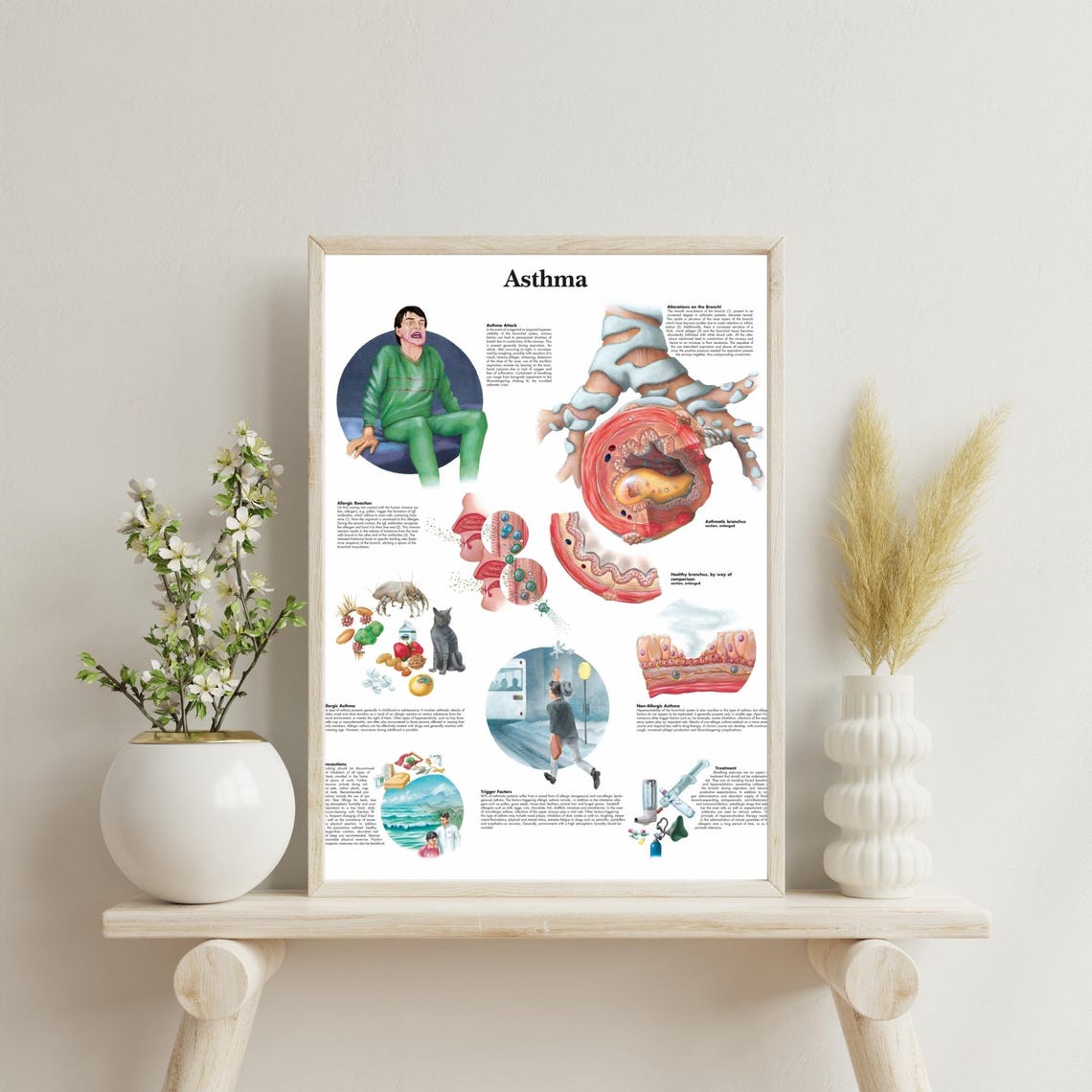 Asthma Chart Anatomy Human Physiology Charts Medical Student Wall ...