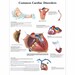 Common Cardiac Disorders Chart Anatomy Human Physiology Charts Medical ...