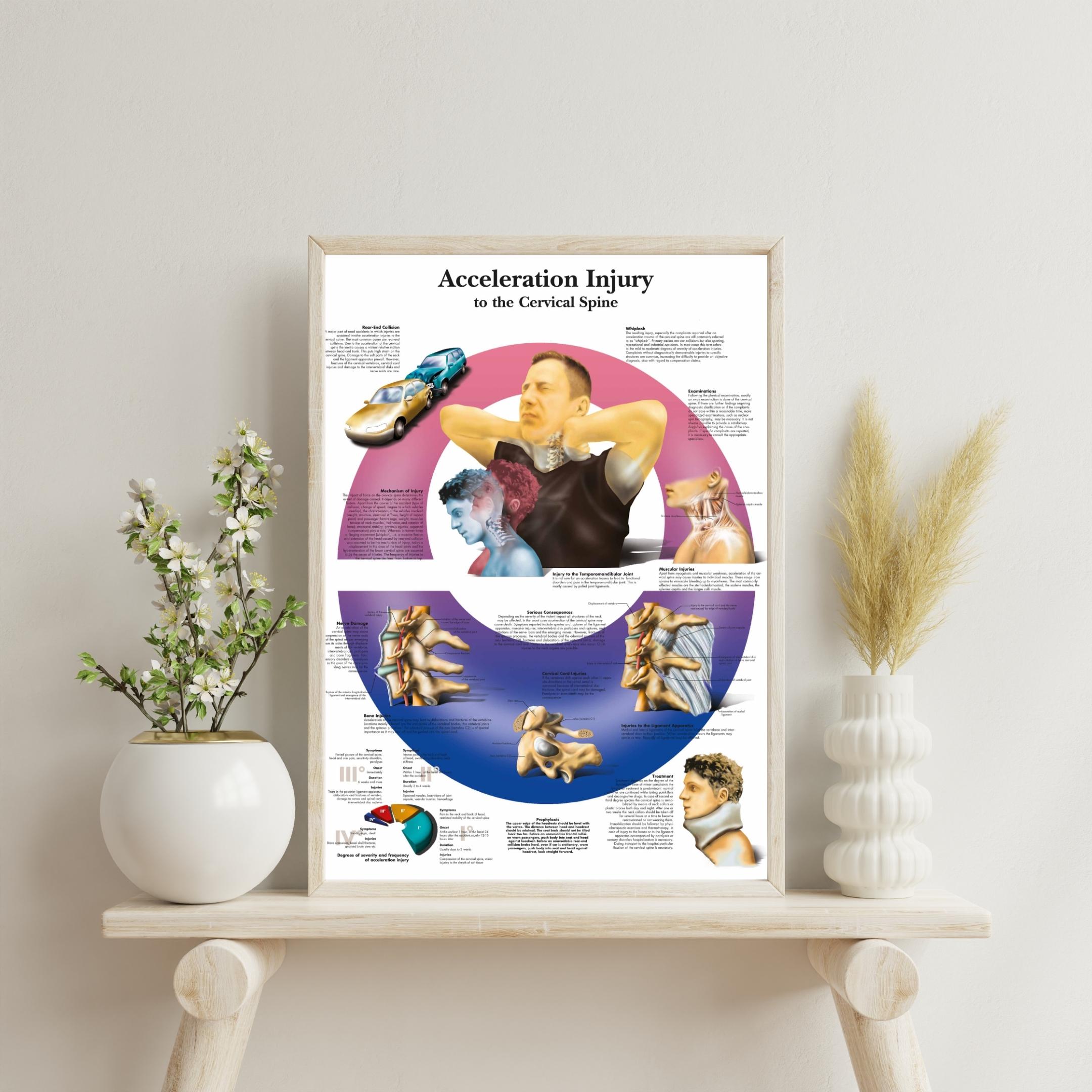 Acceleration Injury Chart Anatomy Human Physiology Charts Medical ...