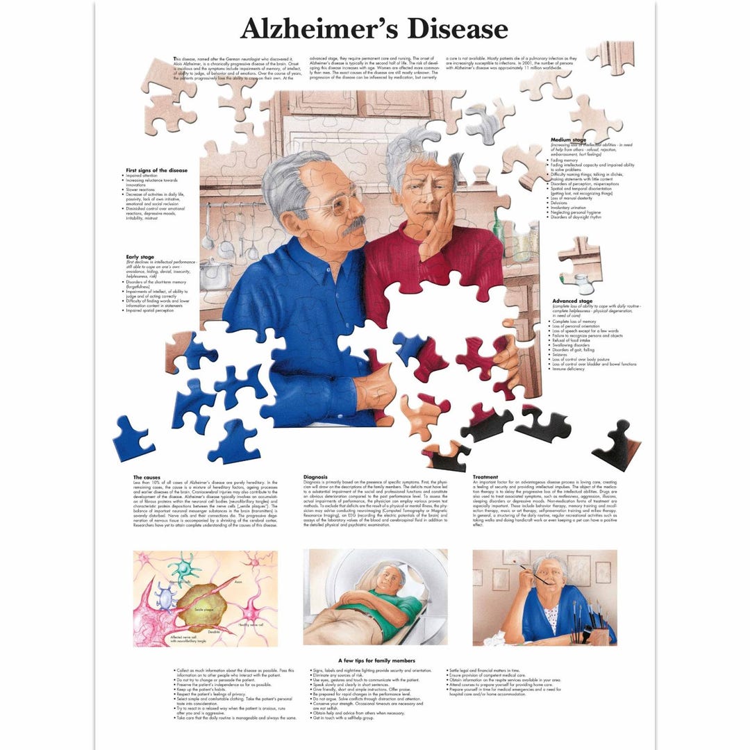 Alzheimer Disease Chart Anatomy Human Physiology Charts Medical Student ...