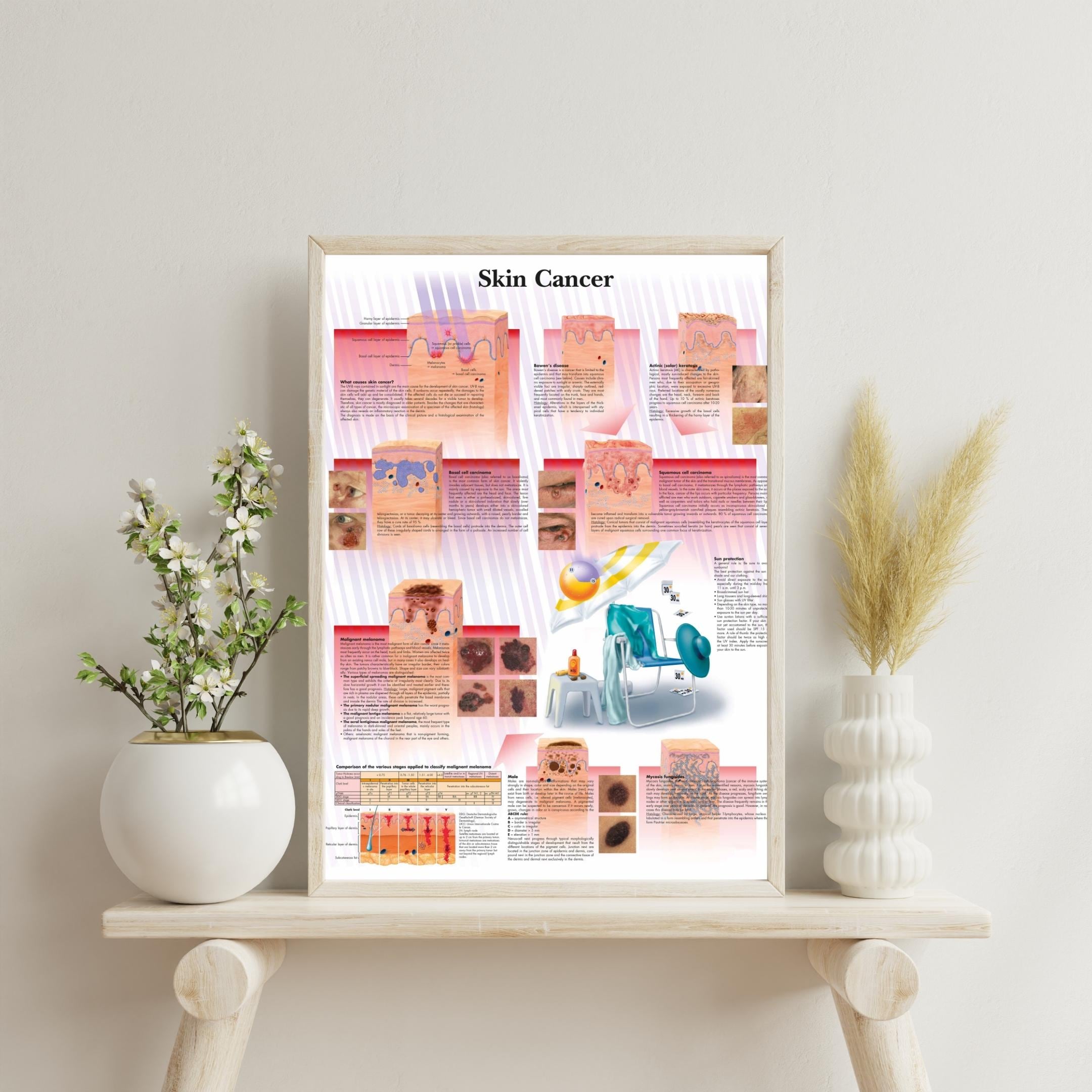 Skin Cancer Chart Anatomy Human Physiology Charts Medical Student Wall ...