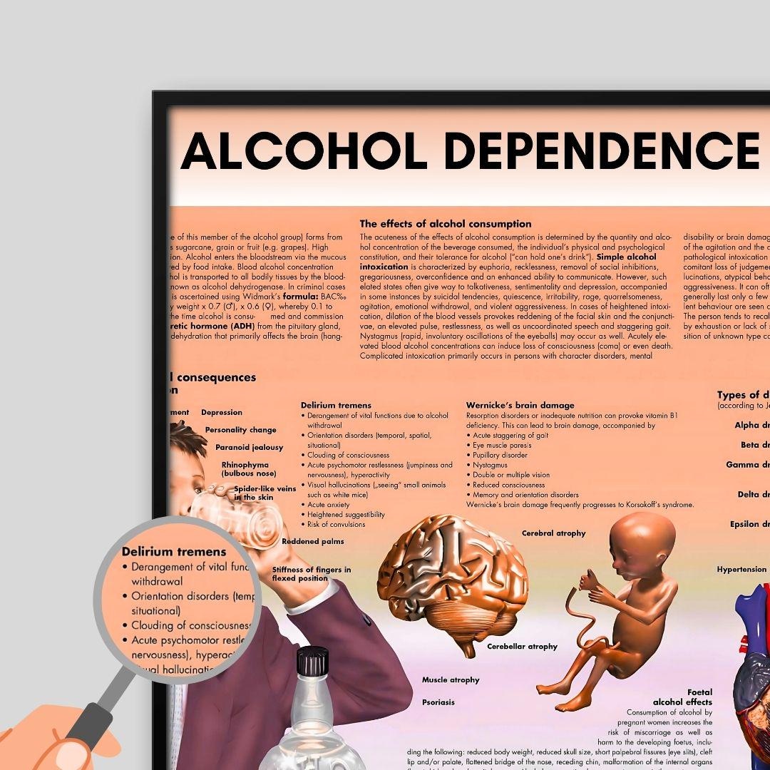 Alcohol Dependence Poster Anatomy Human Biology Poster Medical Student ...