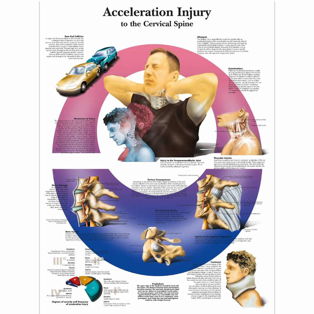 Acceleration Injury Chart Anatomy Human Physiology Charts Medical ...