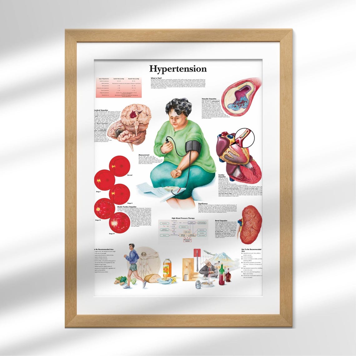 Hypertension Chart Anatomy Human Physiology Charts Medical Student Wall ...