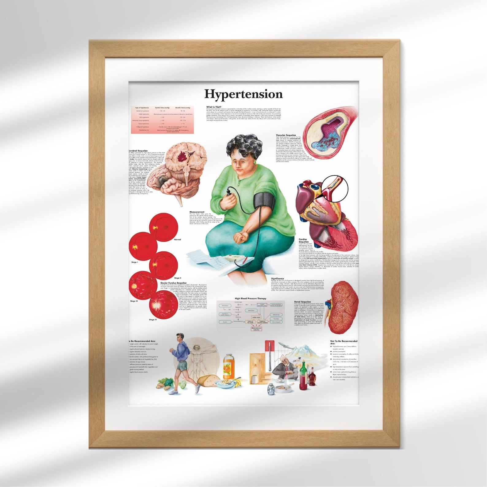 Hypertension Chart Anatomy Human Physiology Charts Medical Student Wall ...