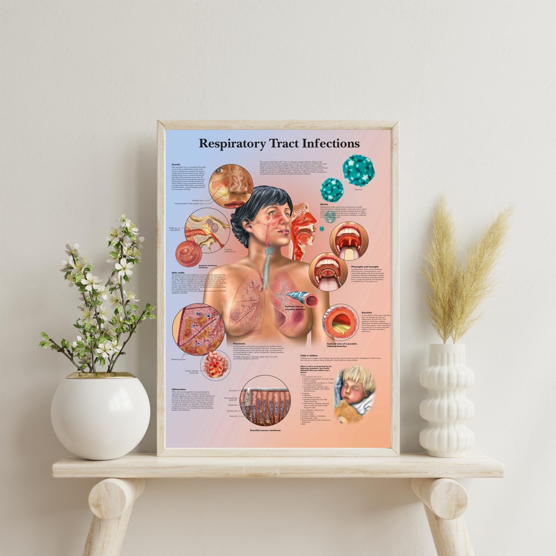 Respiratory Tract Infections Chart Anatomy Human Physiology Charts ...