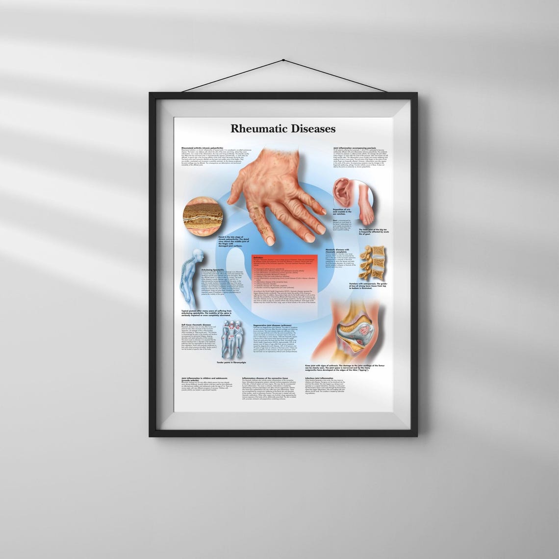 Rheumatic Diseases Chart Anatomy Human Physiology Charts Medical ...