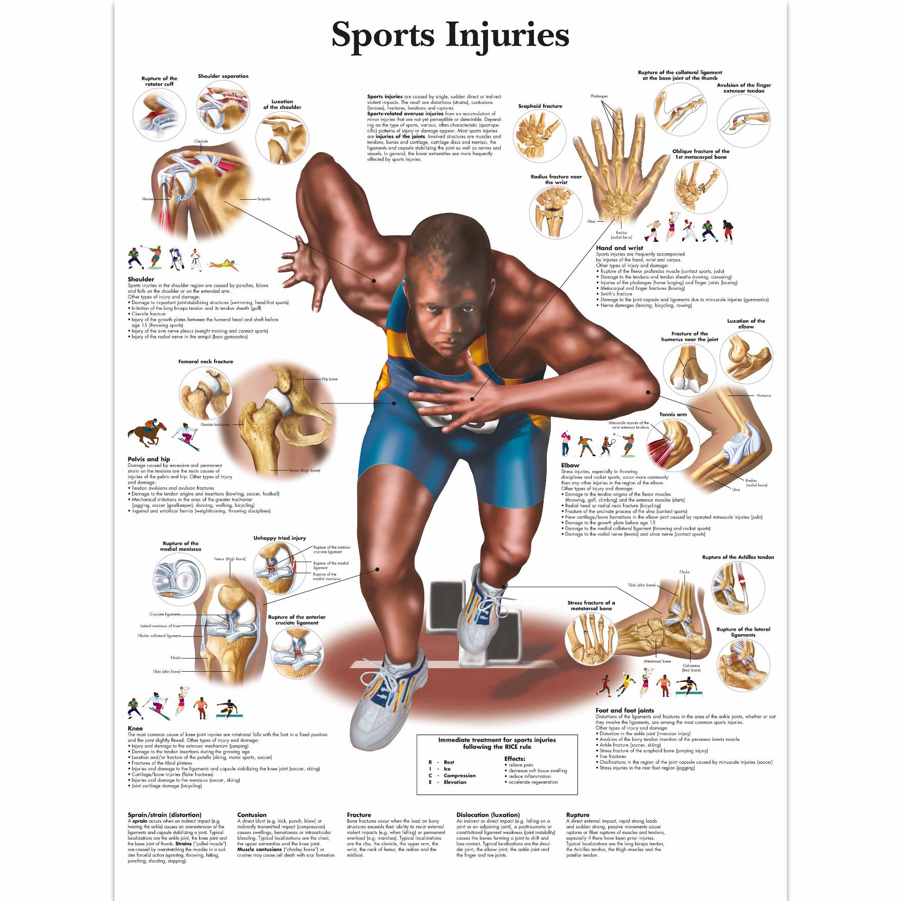 Sports Injuries Chart Anatomy Human Physiology Charts Medical Student ...
