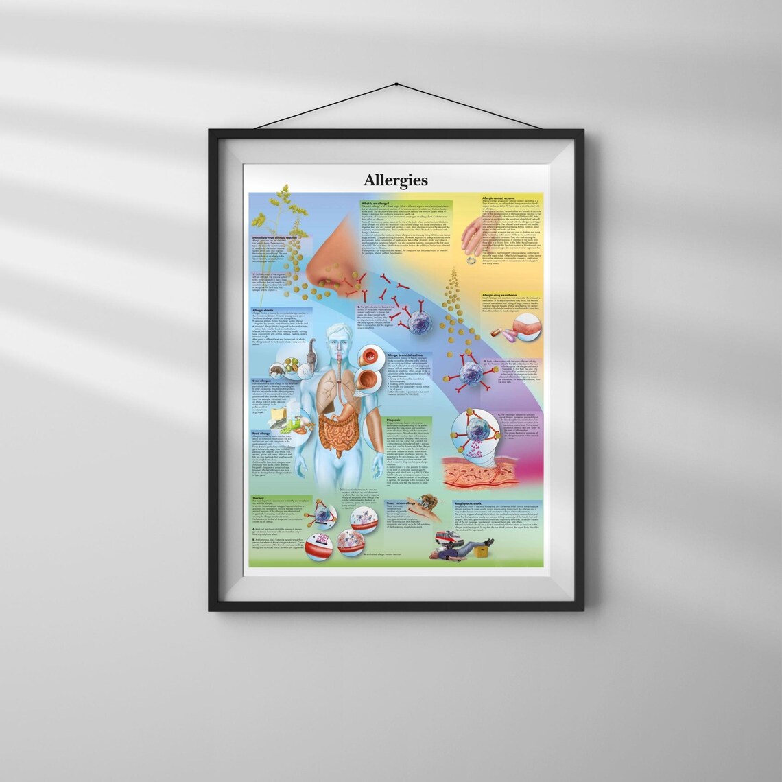 Allergies Chart Anatomy Human Physiology Charts Medical Student Biology ...