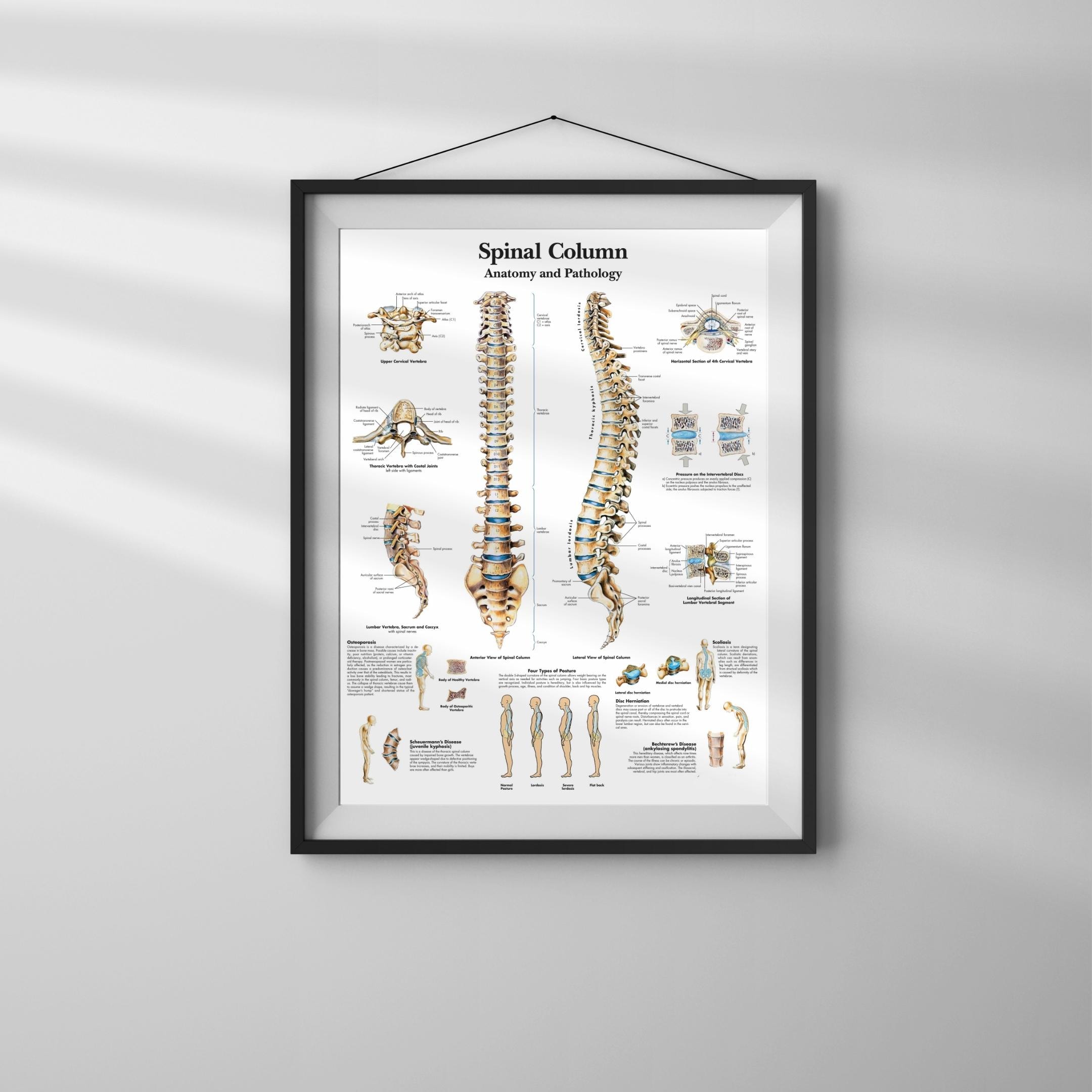 Spinal Column Chart Anatomy Human Physiology Charts Medical Student ...