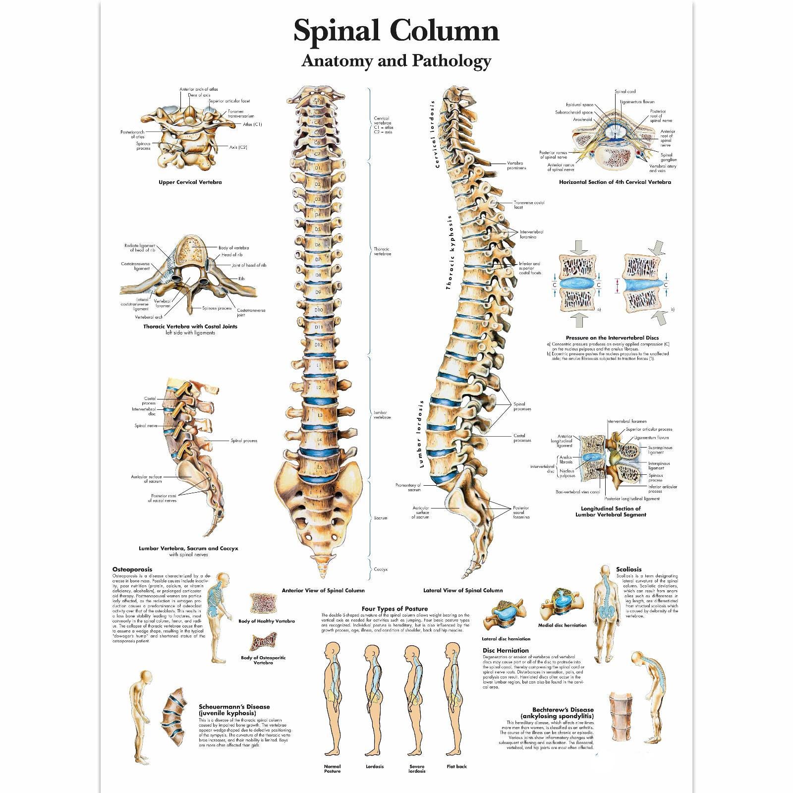 Spinal Column Chart Anatomy Human Physiology Charts Medical Student ...