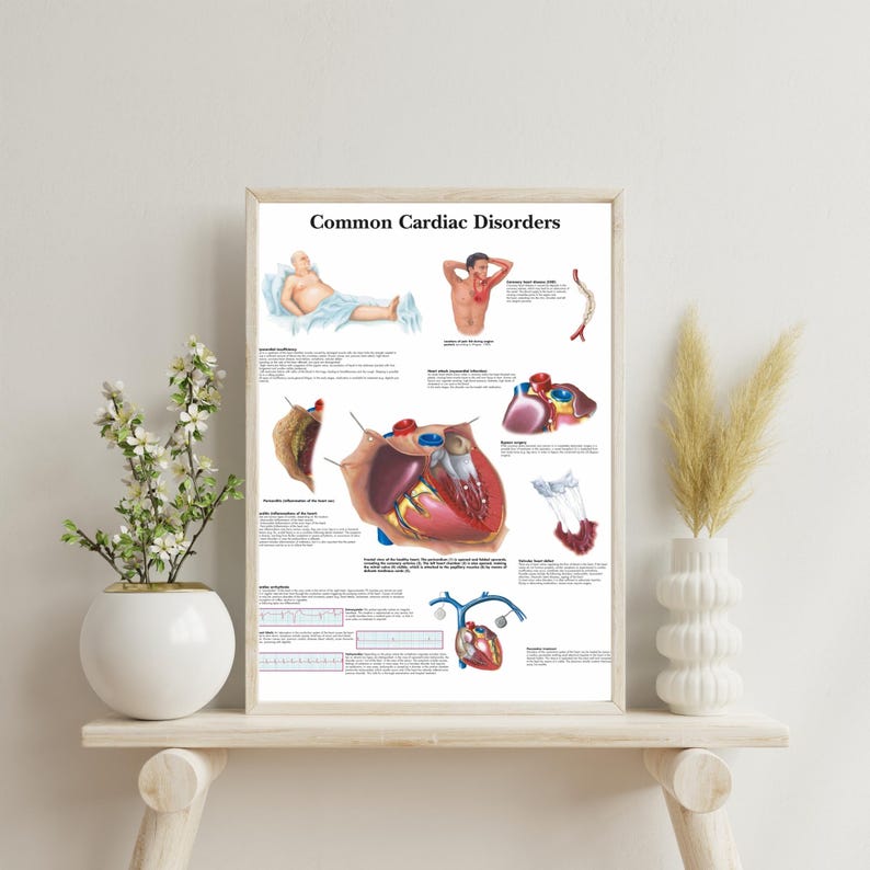 Common Cardiac Disorders Chart Anatomy Human Physiology Charts Medical ...