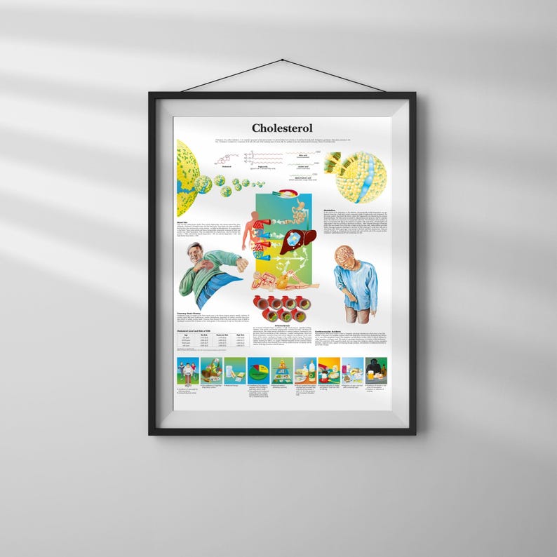 Cholesterol Chart Anatomy Human Physiology Charts Medical Student Wall ...
