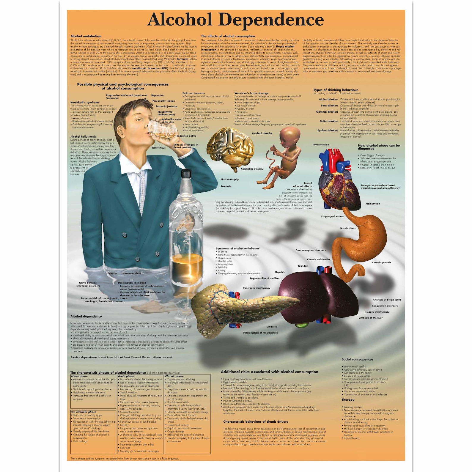 Alcohol Dependence Chart Anatomy Human Physiology Charts Medical ...