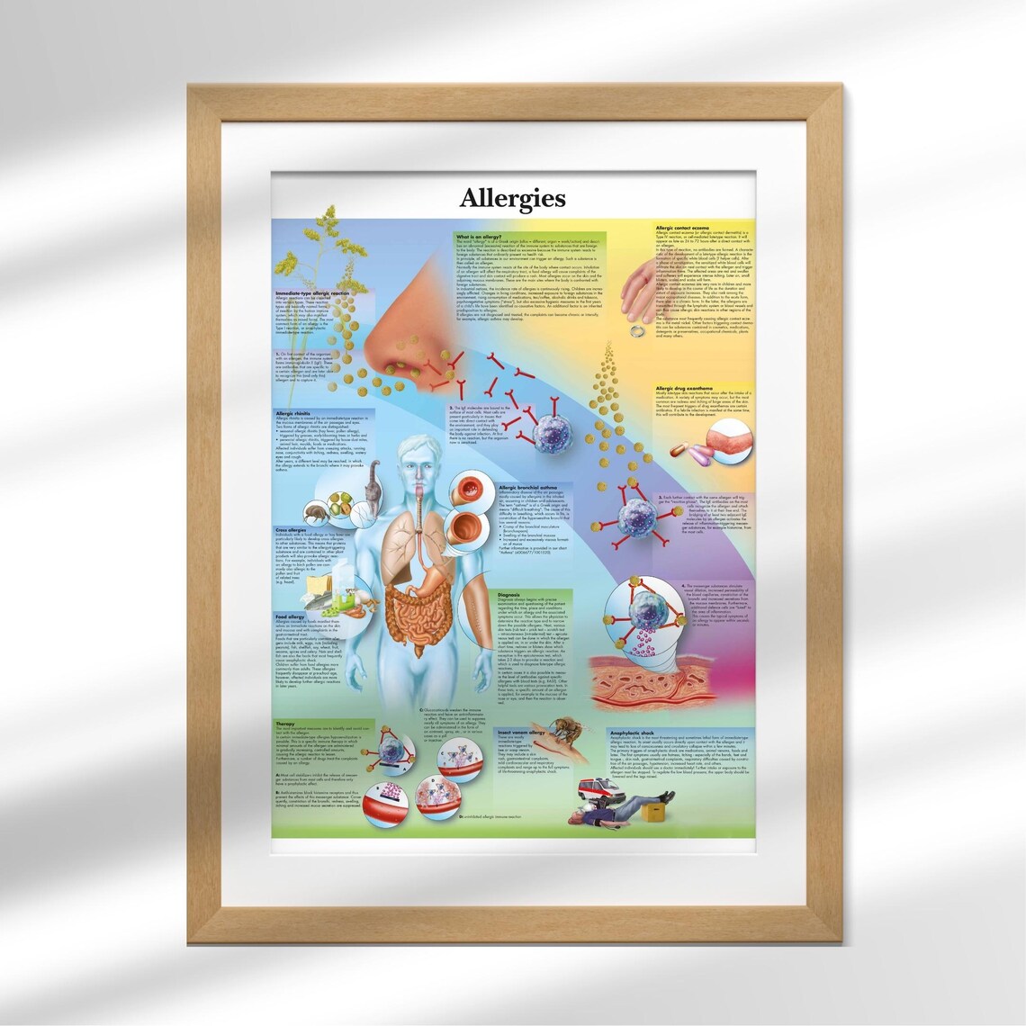 Allergies Chart Anatomy Human Physiology Charts Medical Student Biology ...