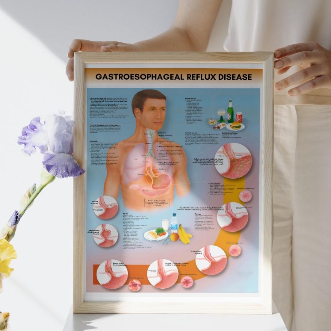 Gastroesophageal Poster Anatomy Human Biology Poster Medical Student ...