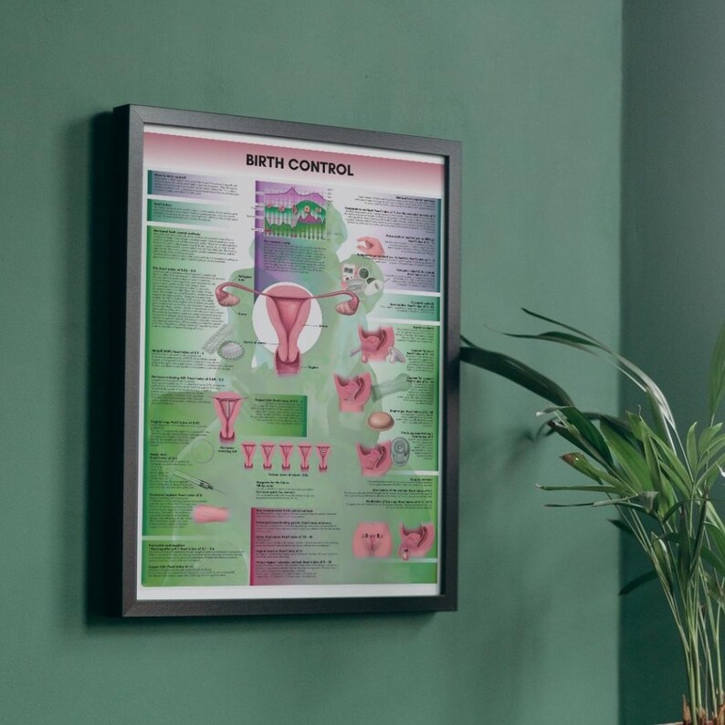 Birth Control Poster Anatomy Human Biology Poster Medical Student ...