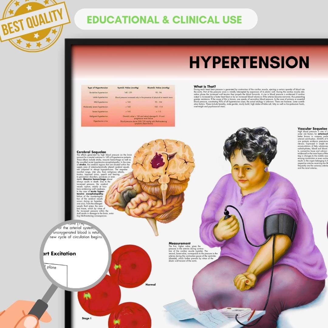 Hypertension Poster Anatomy Human Biology Poster Medical Student Poster ...