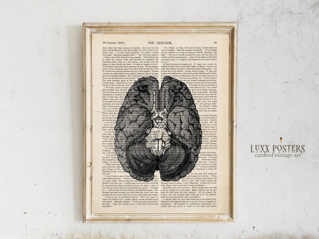 Vintage Brain Drawing | Dark Academia Room Decor | Vintage Medical Art ...