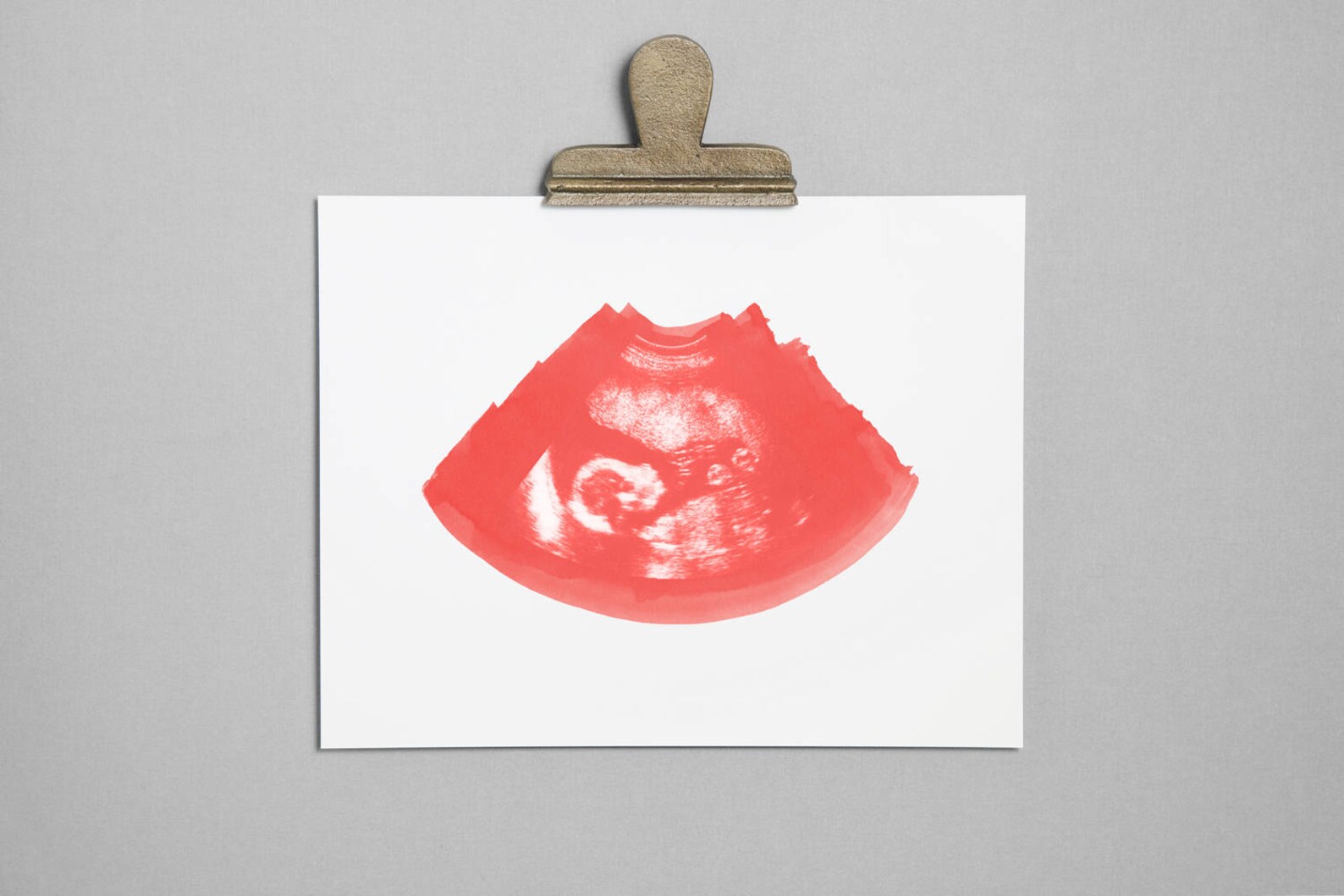 WATERMELON Ultrasound Sonogram Physical Print - Etsy