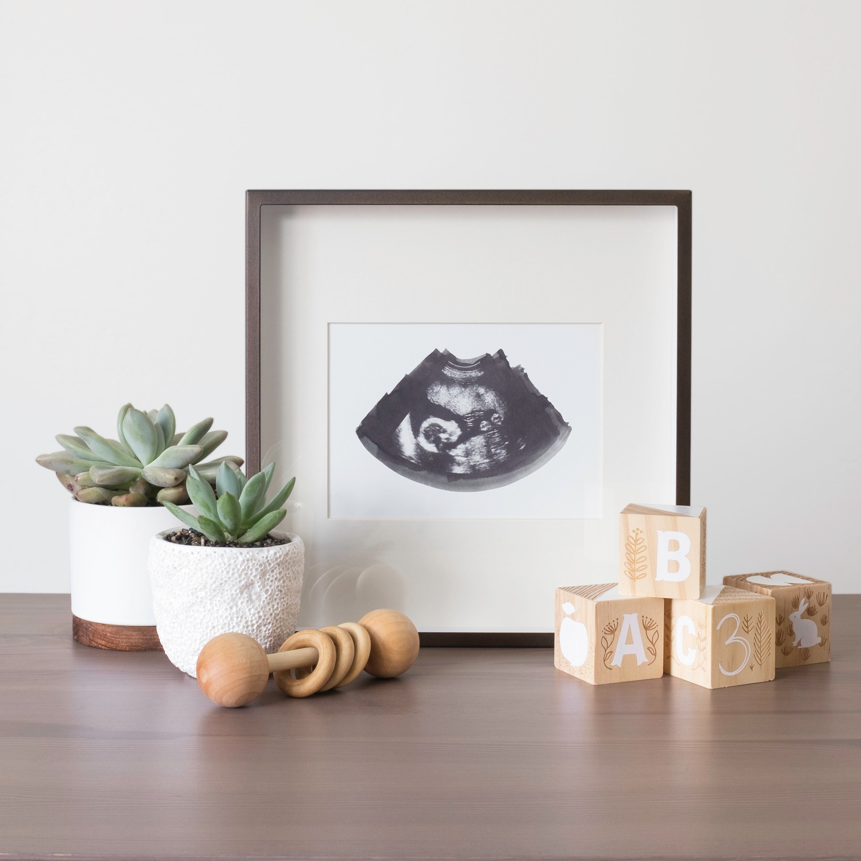 SLATE Ultrasound Sonogram Physical Print - Etsy