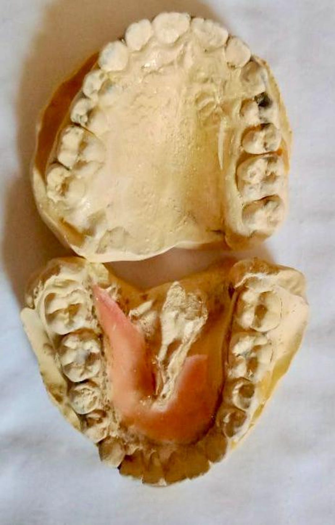 Vintage Cast Dental Teeth Impression Mold Tooth Castings 2 1/2" Wide - Etsy