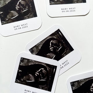 Baby Shower Decorations | Ultrasound Confetti | Custom Decorations Baby ...