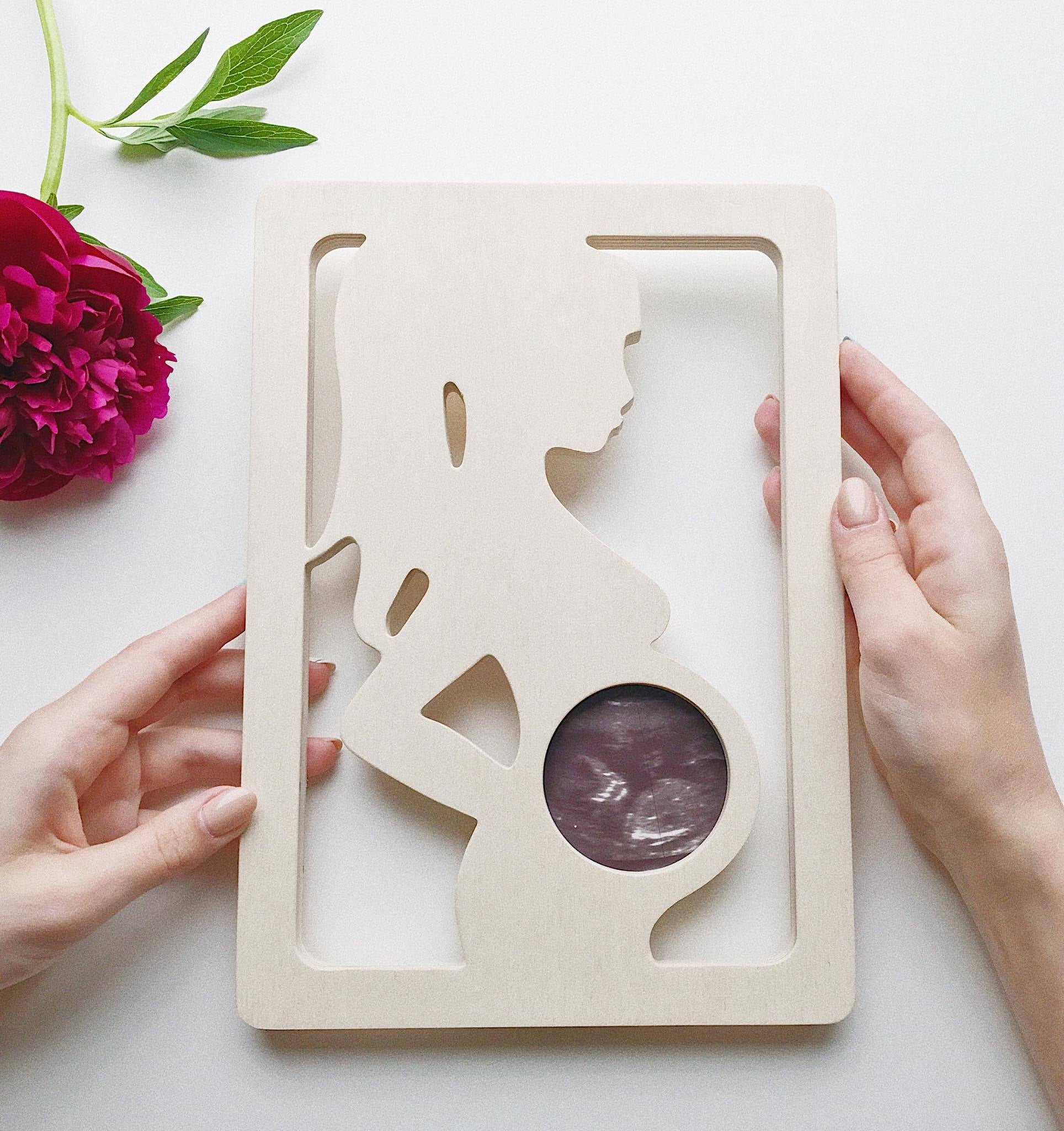 Sonogram - Ultrasound Photo Frame - Baby Ultrasound Picture Frame ...