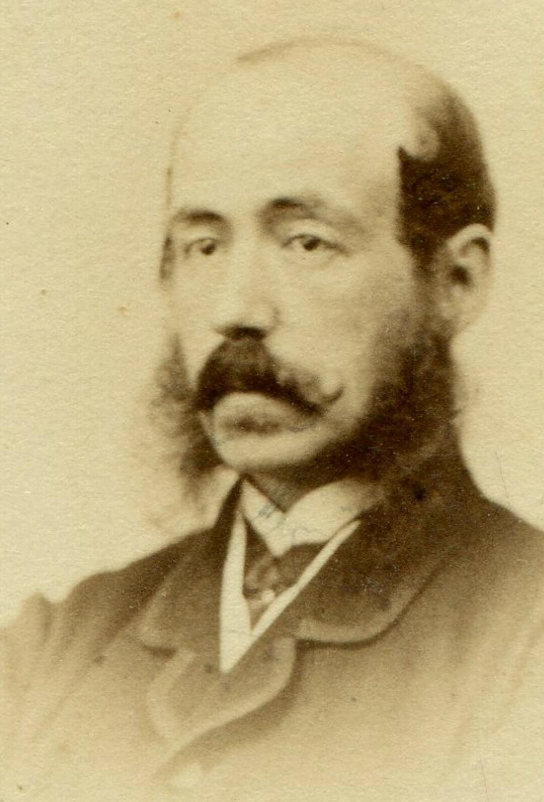 Balding Man W/mutton Chop Sideburns, Mustache and Bored Expression. Cdv ...