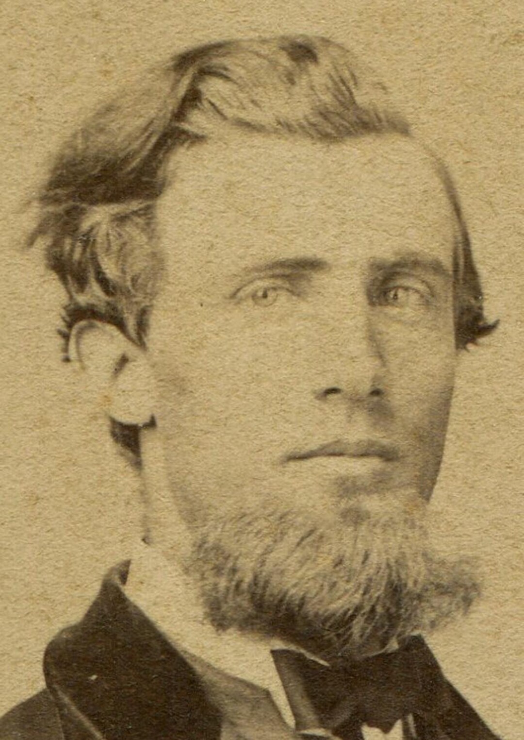 Long Faced Man With Fuzzy Chin Beard. Cdv Signed at Bottom. - Etsy