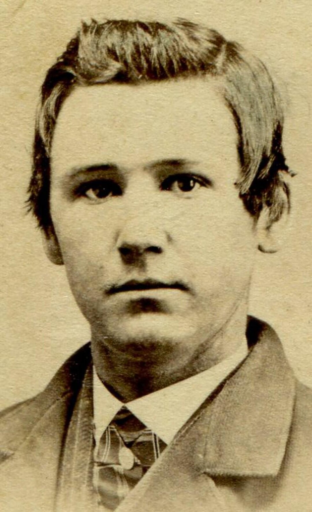 Puddy Faced Young Man, Thick Hair. Cdv. Troy, N.y. - Etsy
