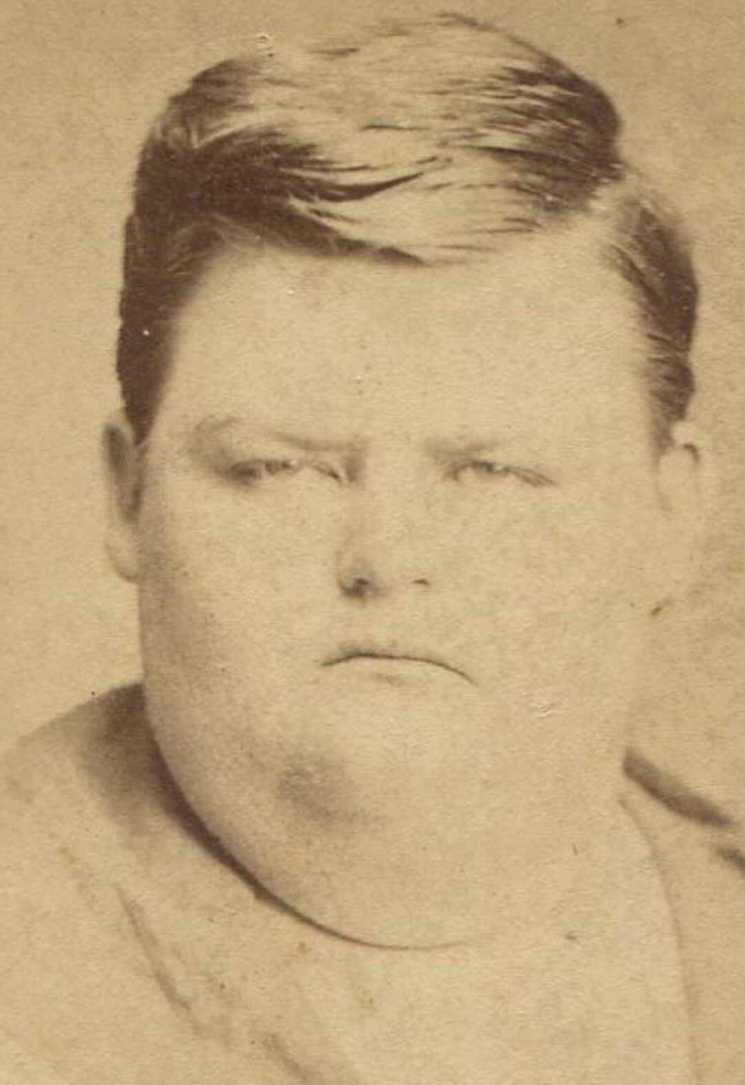 Chauncey Morlan, Circus Fat Man. CDV by Chas Eisenmann. N.y. - Etsy