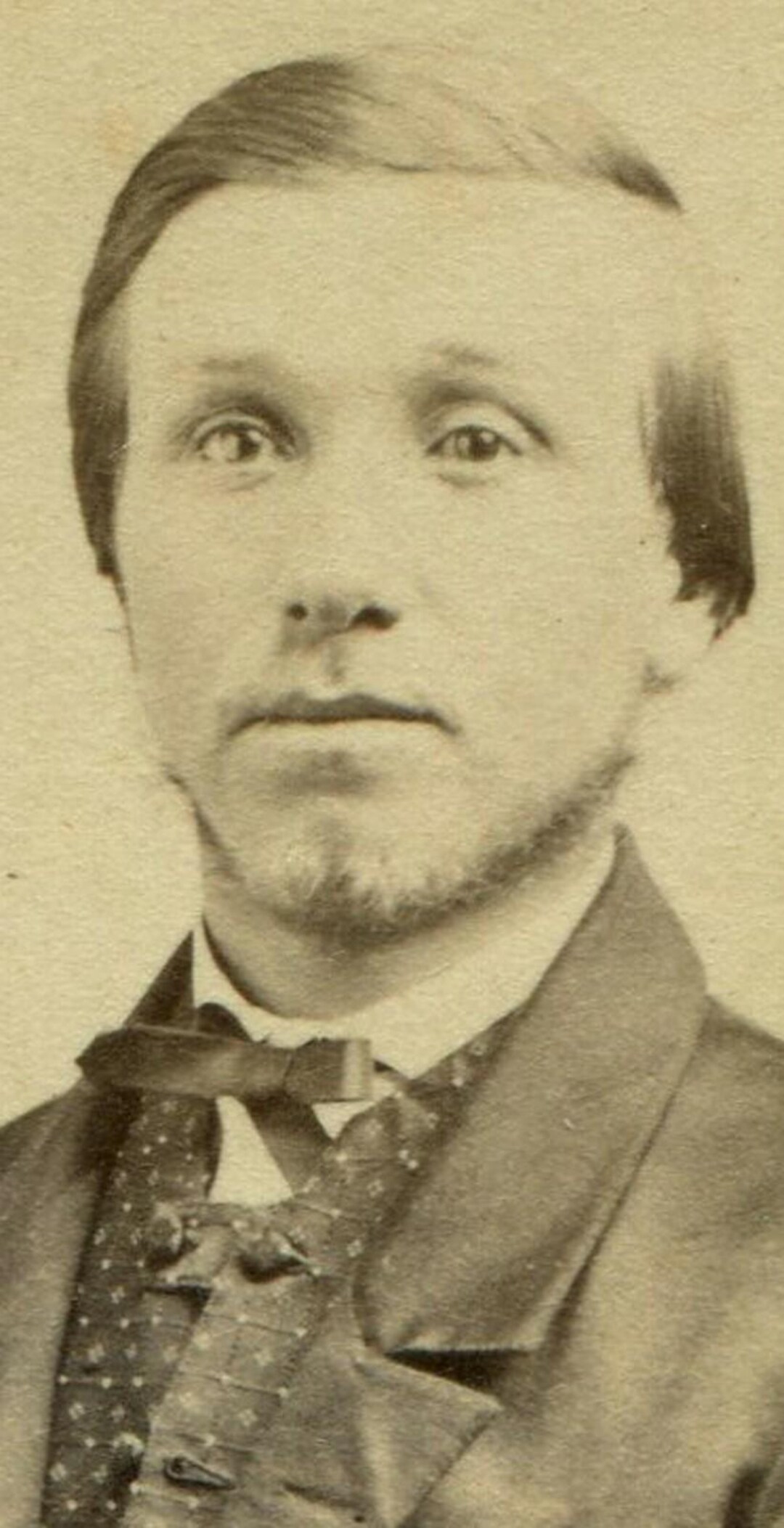Young Man W/ A Whisper of A Beard. Cdv. St. John, New Brunswick, Canada ...