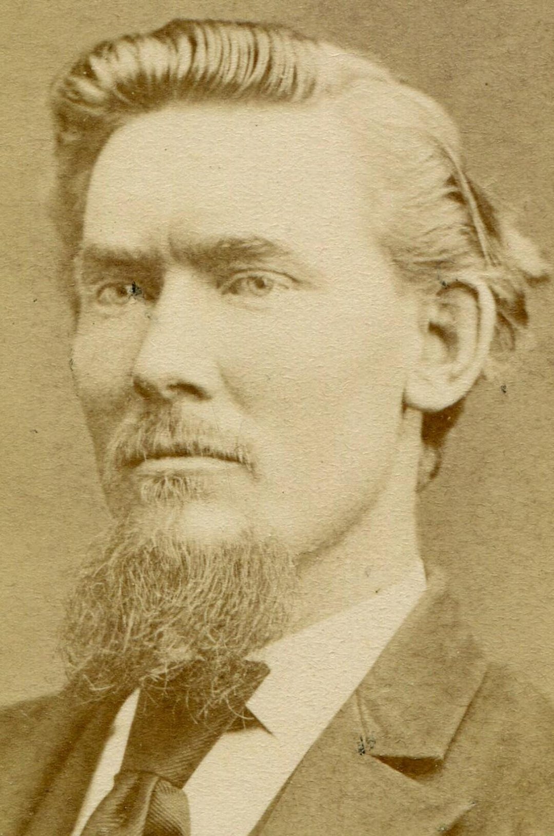 Beady Eyed Man, Stringy Beard. Unique Cdv, Signed. Fulton, Illinois. - Etsy