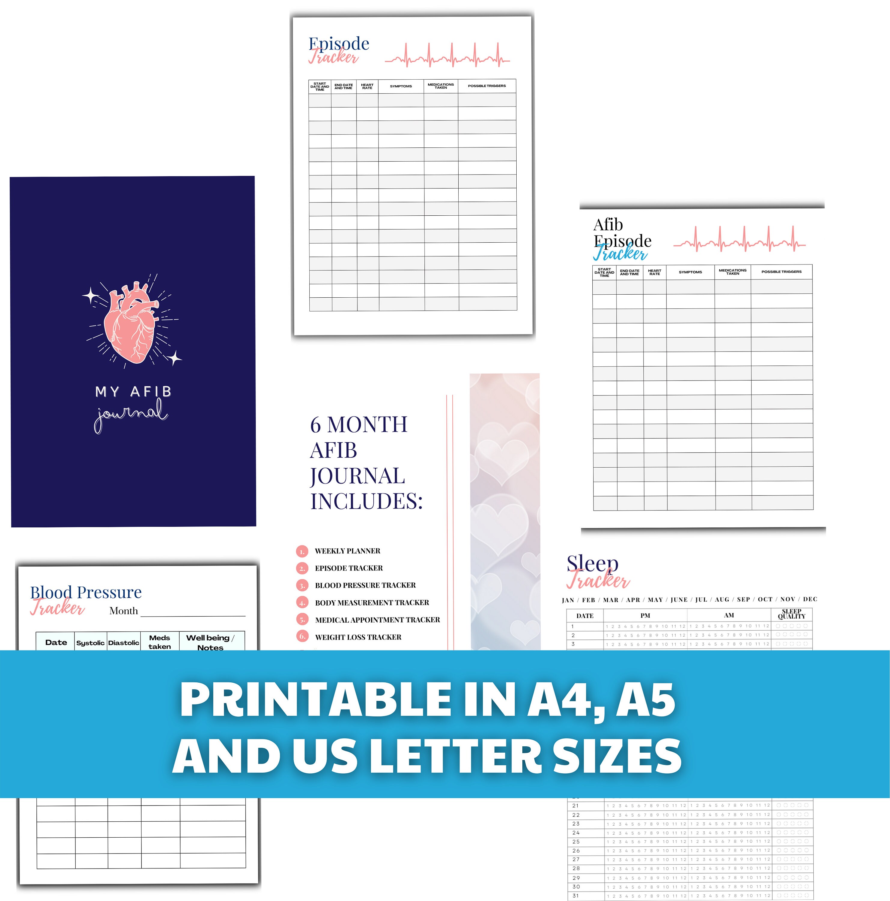 Afib & Heart Health Journal: 6-month Episode Tracker (printable) - Etsy