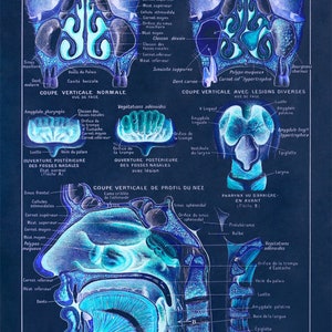 Human Anatomy Nose Chart Print, Scientific Illustration, 3 Color ...