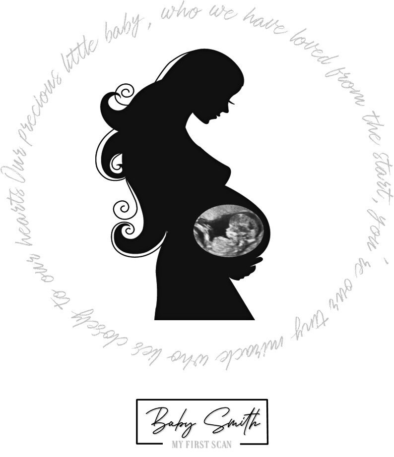 PERSONALISED BABY SCAN Ultrasound Print Bump Gift Baby Scan - Etsy