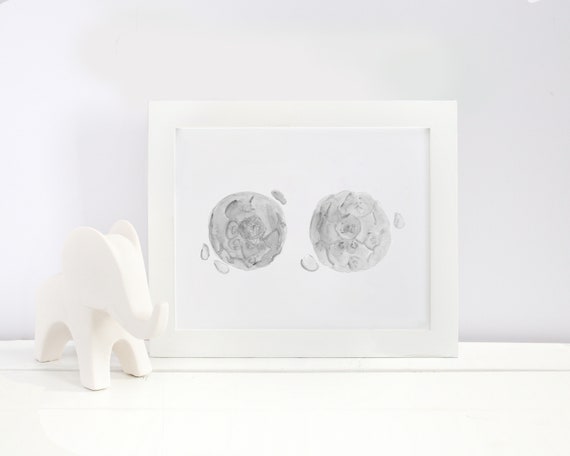 Custom Watercolor Embryo Painting - Etsy