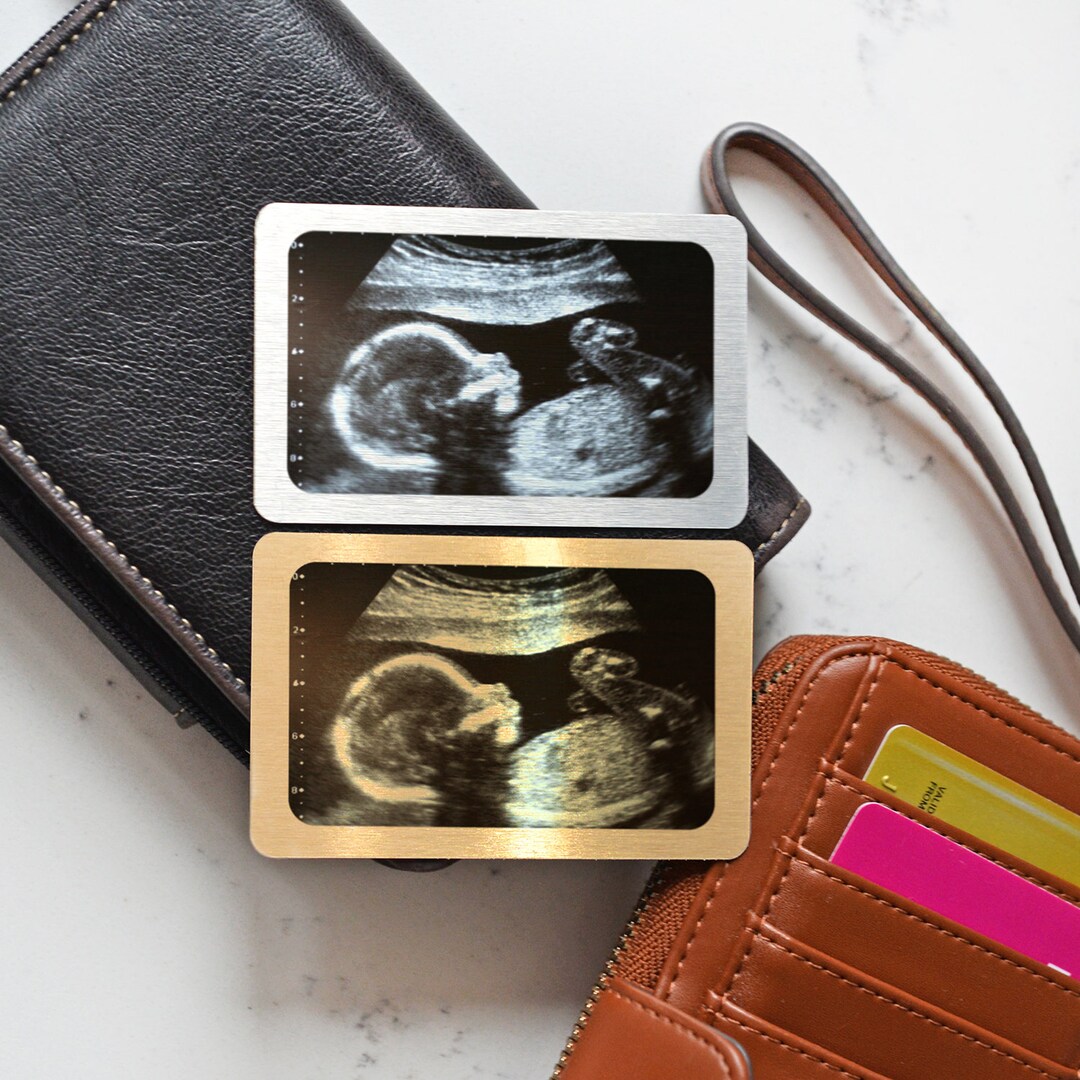 Personalised Baby Scan Wallet Metal Photo Cards - Etsy