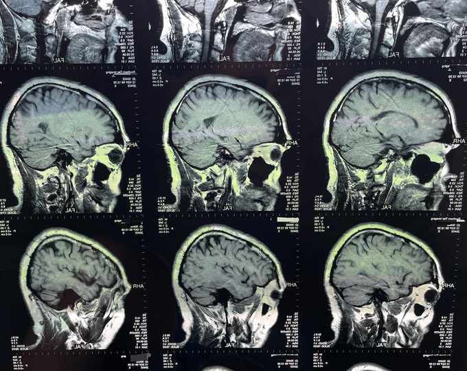 Vintage Brain Xray Film, Head CT Scan, Halloween Decor, 17” X 14” - Etsy