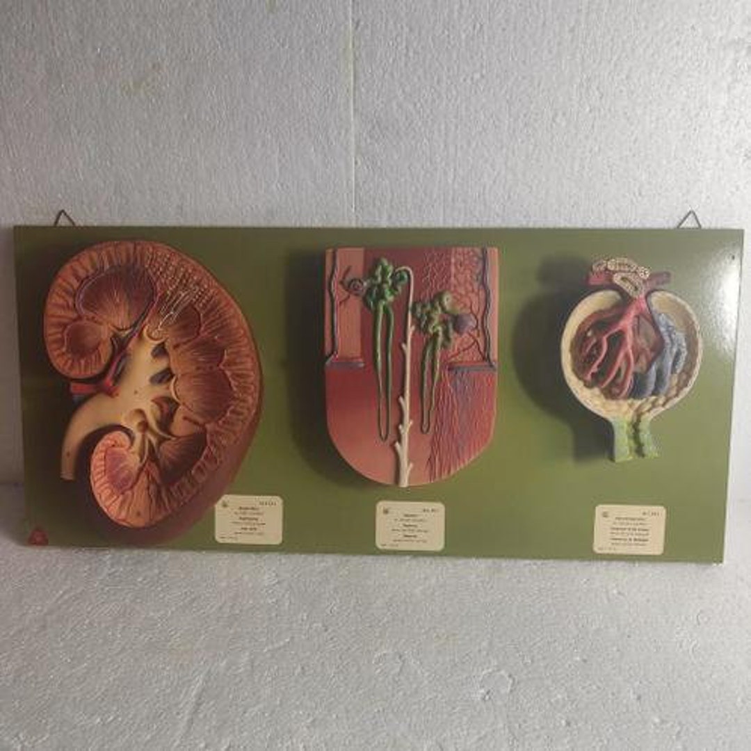 Human Kidney, Kidney Anatomy: Large Vintage Anatomical Model SOMSO - Etsy