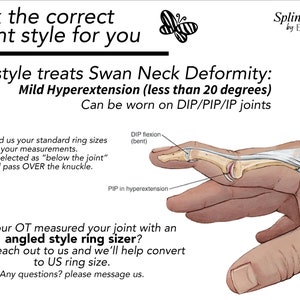 Garnetswan Splint Ring • Sterling Silver Swan Neck Splint for PIP, DIP ...