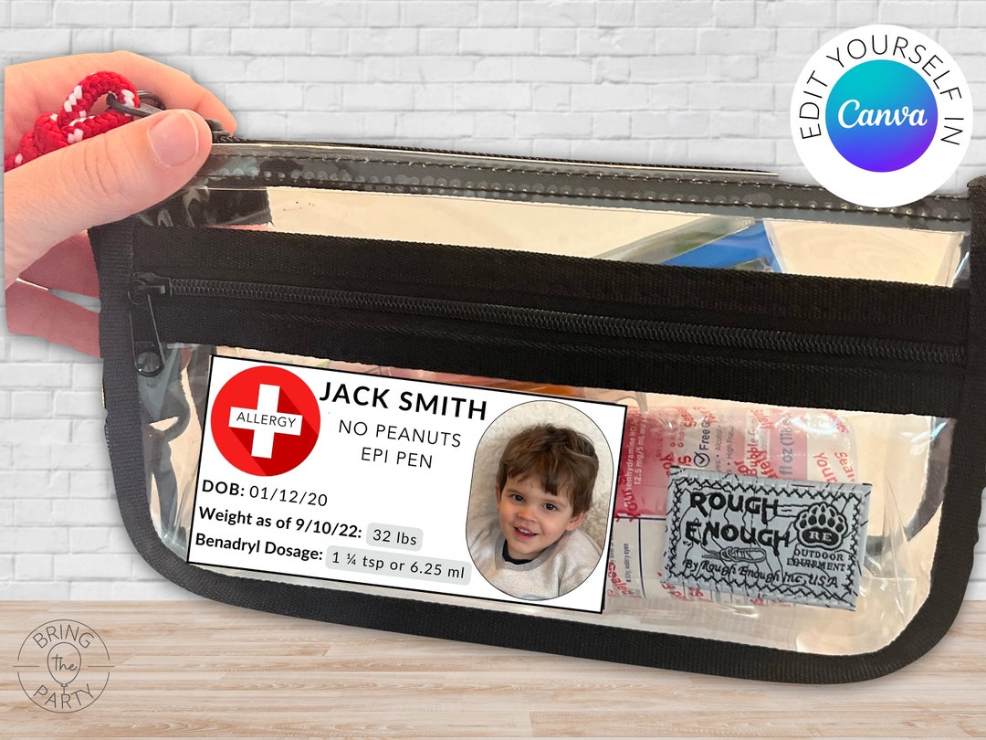 Editable Allergy Alert Card | Allergy Note | Child Allergy Card ...