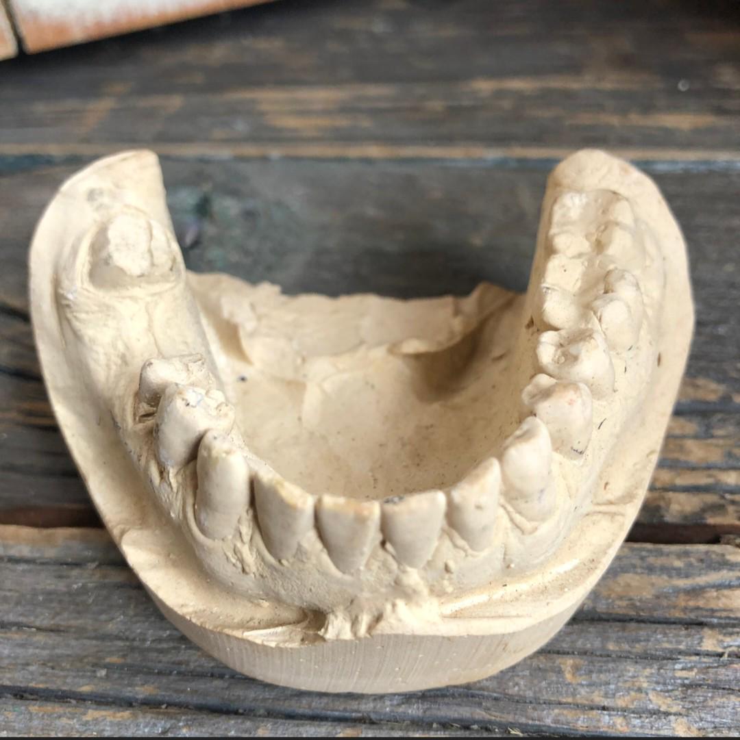 Antique Plaster Teeth Mold - Etsy