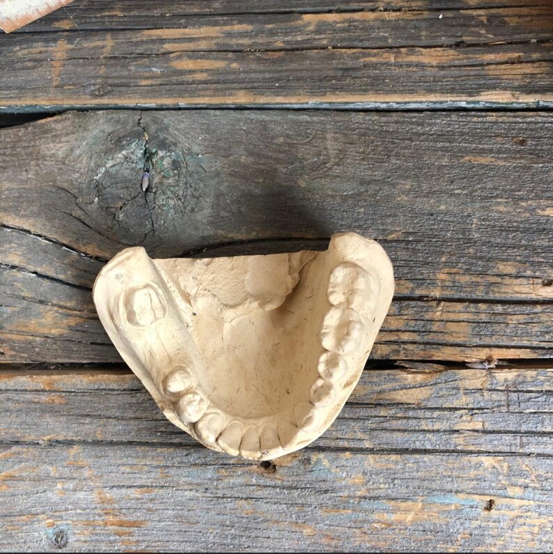 Antique Plaster Teeth Mold - Etsy