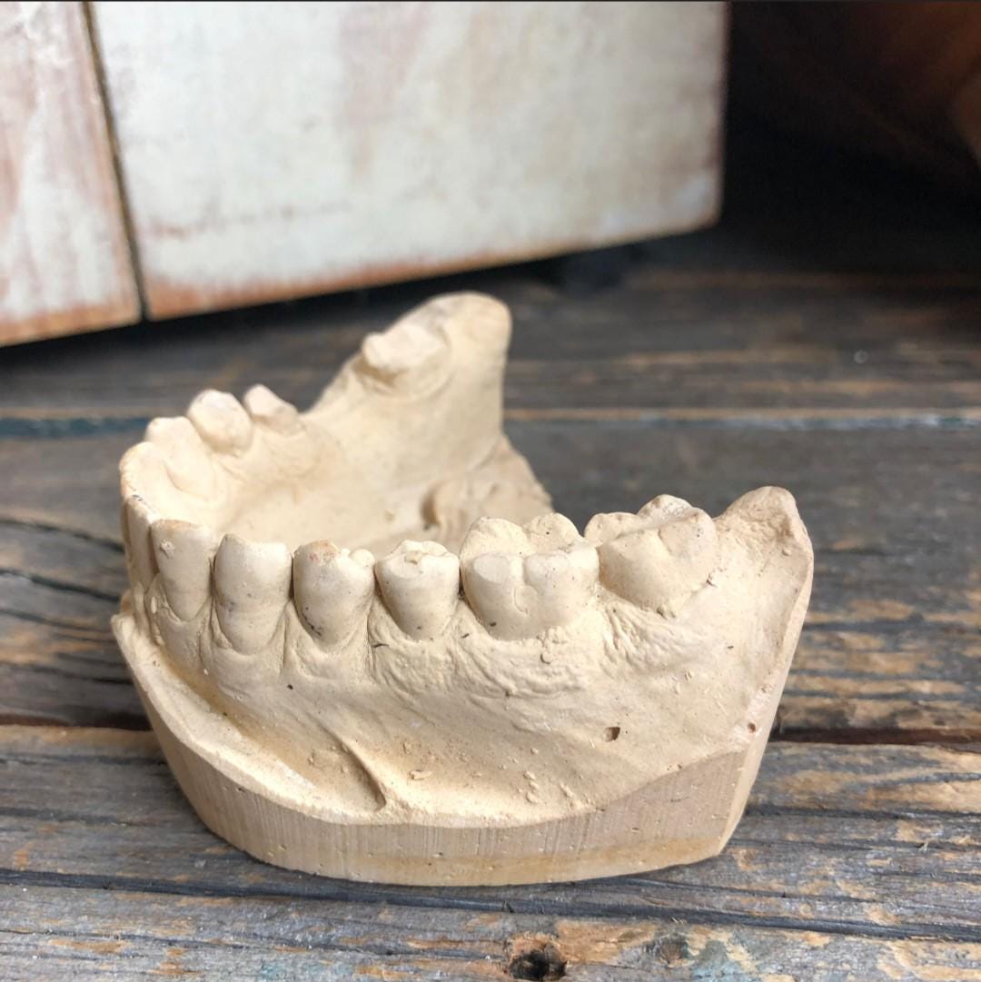 Antique Plaster Teeth Mold - Etsy