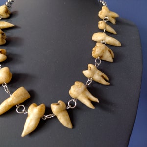 Aged Human Teeth Necklace on Silver (look) Chain - Etsy